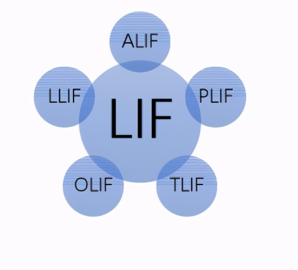 LLIF-微创外侧腰椎椎体入路的外科血管解剖_江伟_副主任医师_爱问健康